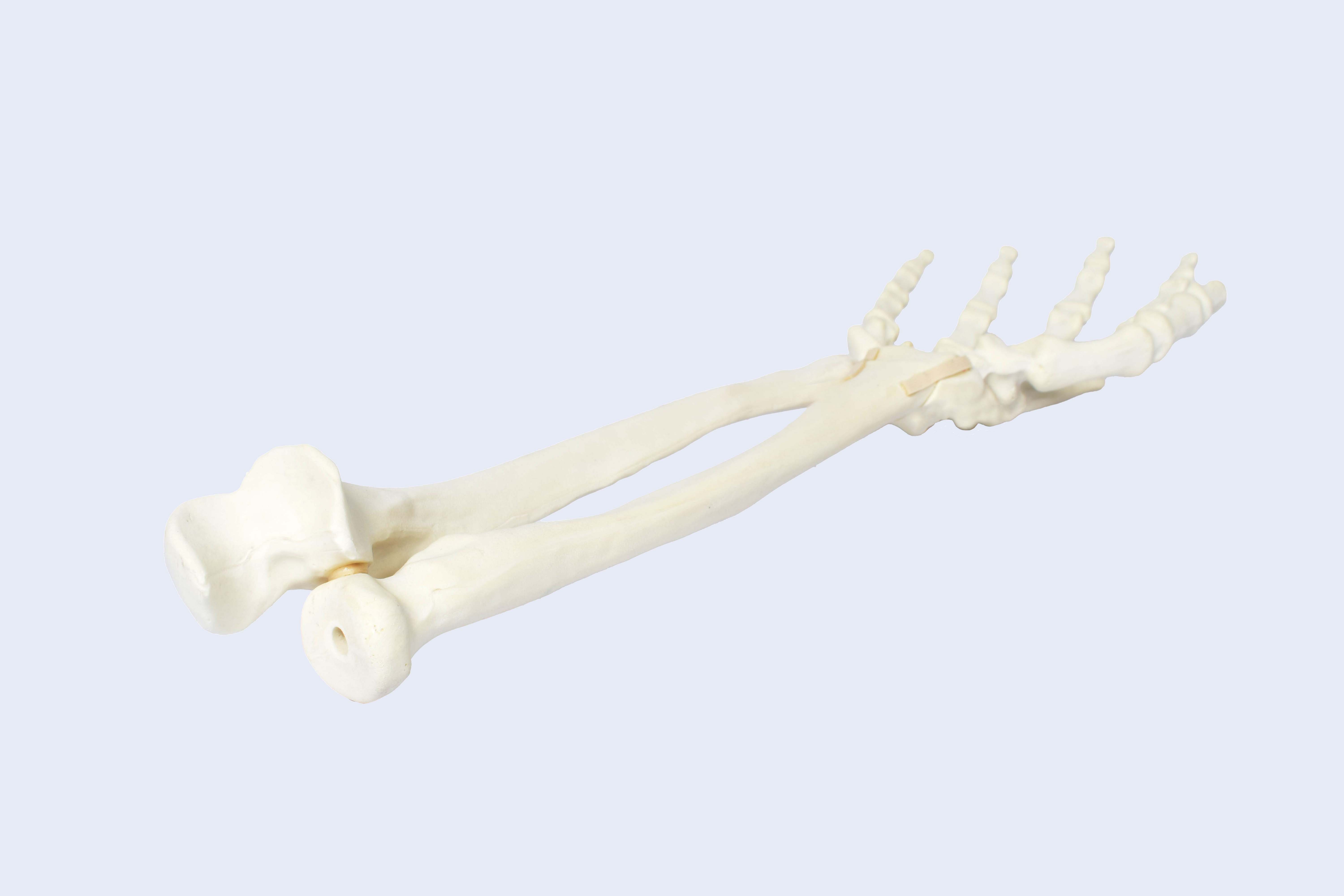 Right Ulna Anterior View Of Right Ulna Stock Photo Alamy