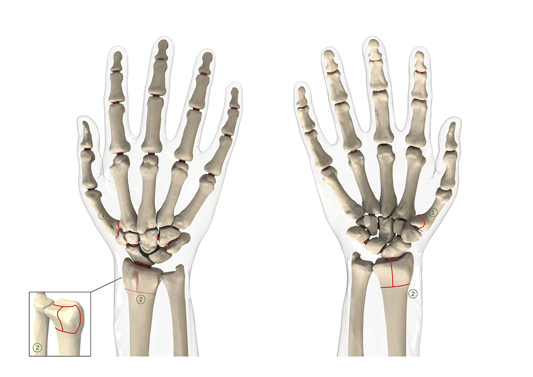 Bones Of The Right Hand And Wrist